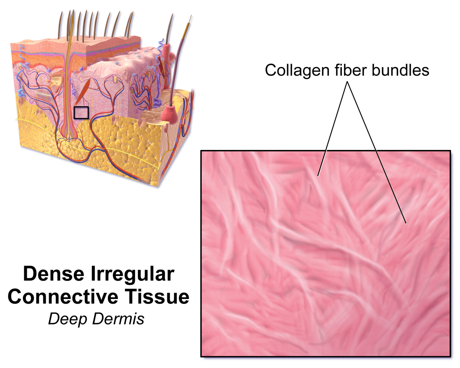 Dense Irregular Connective Tissue - Biology Simple